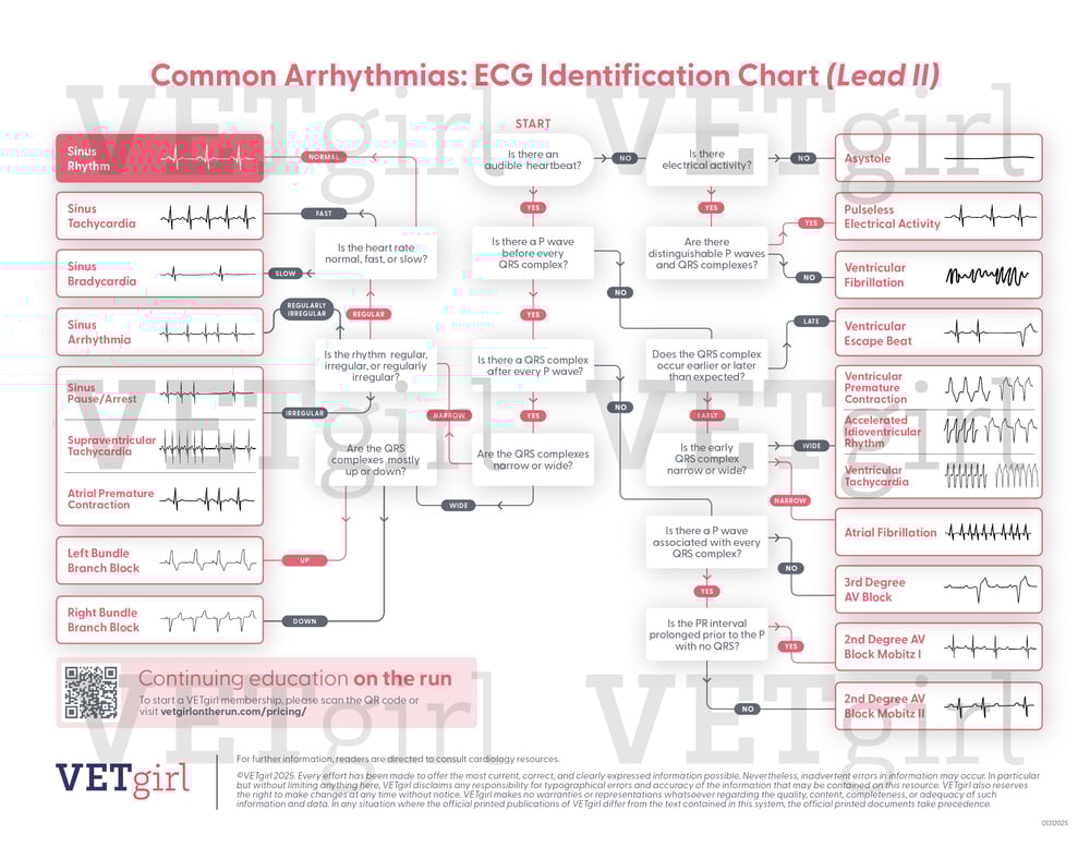 ECG Identification Chart